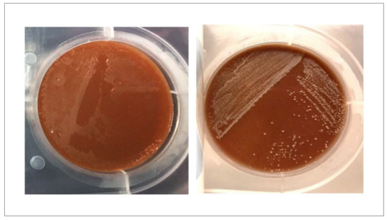 Evaluation of InTray Cassettes Directly from Blood Cultures for the ...