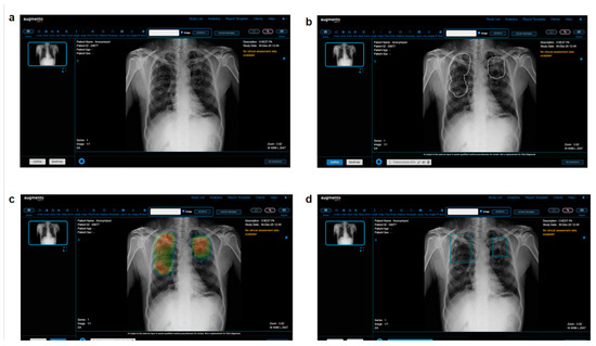 Diagnostics | Free Full-Text | Validation of a Deep Learning Model for ...