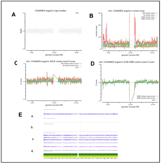 Evaluation and Analysis of Absence of Homozygosity (AOH) Using Chromosome Analysis by Medium ...