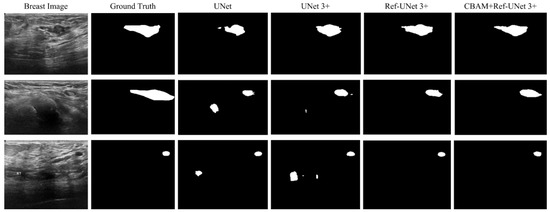 A Medical Image Segmentation Method Based on Improved UNet 3+ Network
