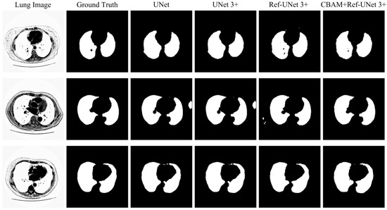 A Medical Image Segmentation Method Based on Improved UNet 3+ Network