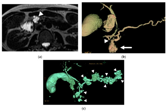 The Role of Magnetic Resonance Imaging (MRI) in the Diagnosis of ...