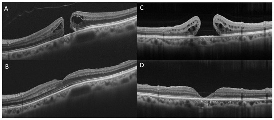 Non-Invasive Retinal Imaging Modalities for the Identification of ...