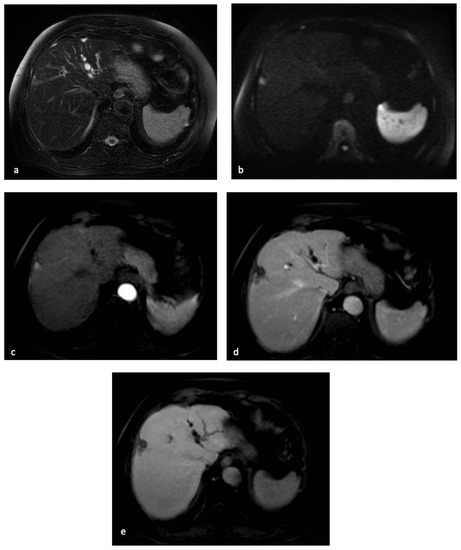 Imaging Diagnosis of Hepatocellular Carcinoma: A State-of-the-Art Review