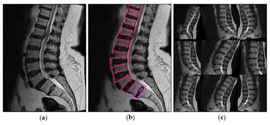 Diagnostics | Free Full-Text | Automatic Detection, Classification, and ...