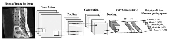 Automatic Detection, Classification, and Grading of Lumbar Intervertebral Disc Degeneration ...