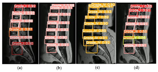 Diagnostics | Free Full-Text | Automatic Detection, Classification, and ...
