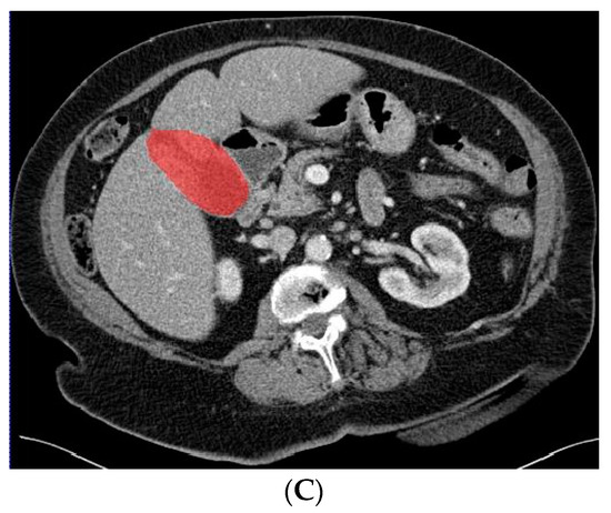 Diagnostics | Free Full-Text | The Value of Deep Learning in ...