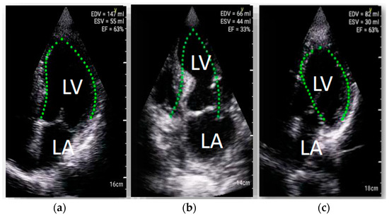 Integrated Assessment of Heart, Lung and Lower Extremity Veins Using ...