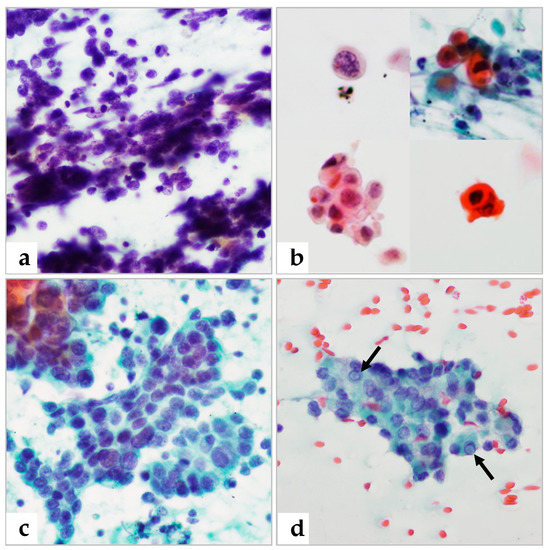 Utility and Limitations of Fine-Needle Aspiration Cytology in the ...