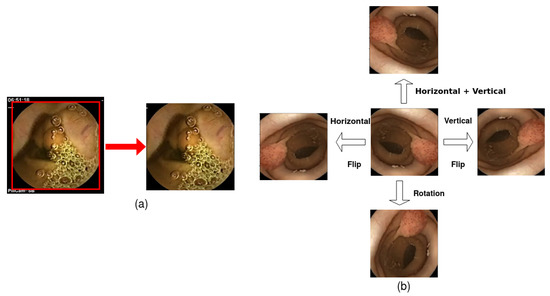 A Multiscale Polyp Detection Approach for GI Tract Images Based on ...