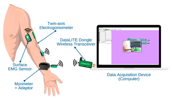 Diagnostics | Free Full-Text | Clinical Spasticity Assessment Assisted ...