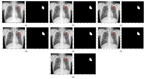 Assessing the Impact of Image Resolution on Deep Learning for TB Lesion ...