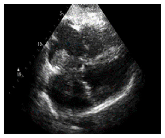IoT-Enabled Classification of Echocardiogram Images for Cardiovascular Disease Risk Prediction ...