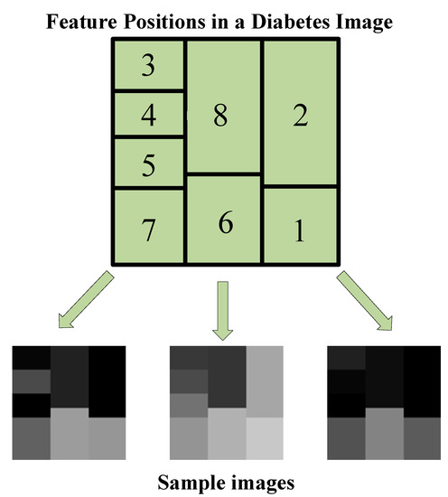 Diagnostics | Free Full-Text | A Novel Proposal for Deep Learning-Based ...