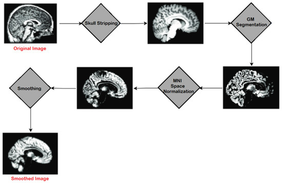 Alzheimer Disease Classification through Transfer Learning Approach