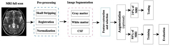 Alzheimer Disease Classification through Transfer Learning Approach