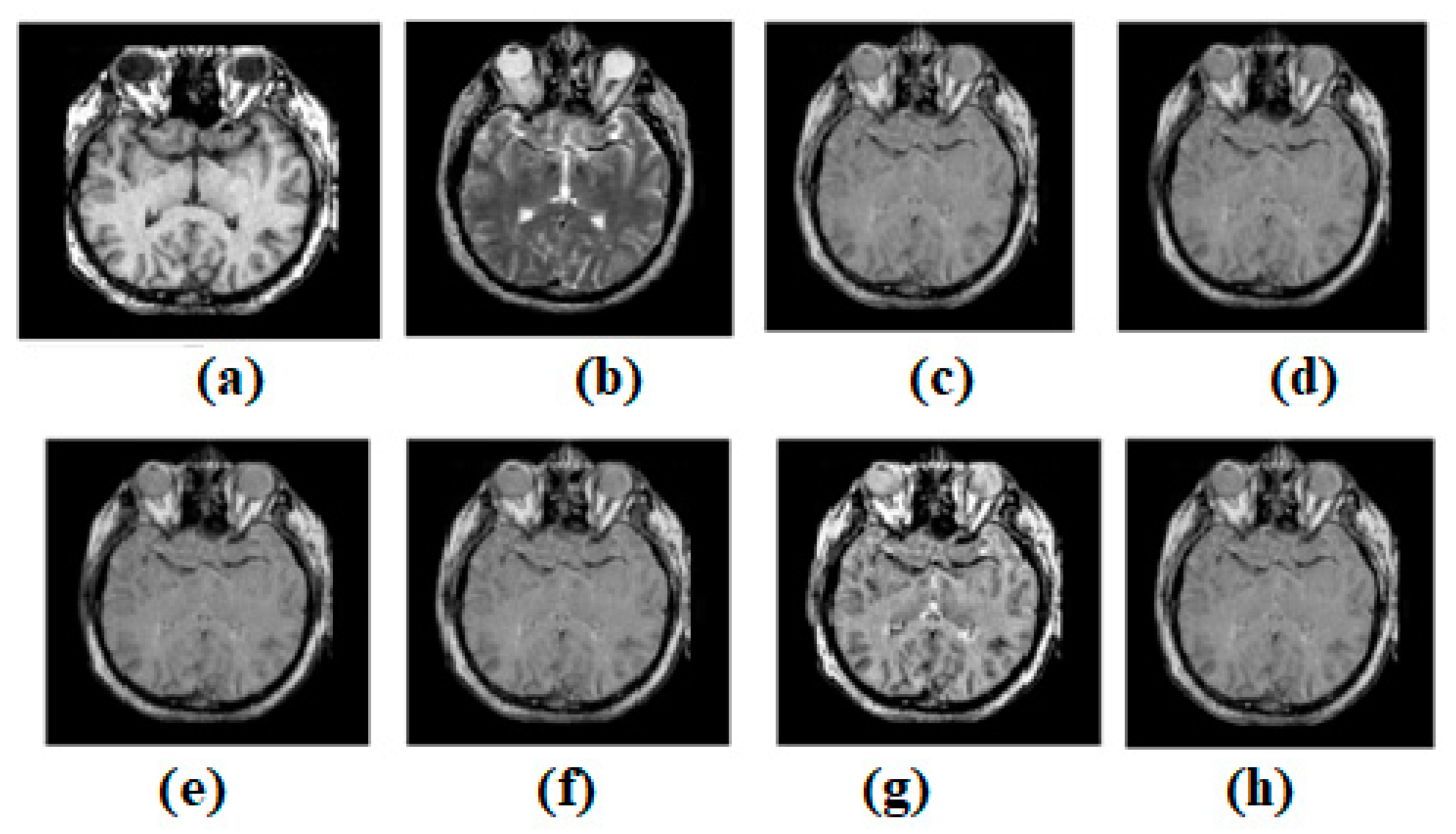 A Non-Conventional Review on Multi-Modality-Based Medical Image Fusion