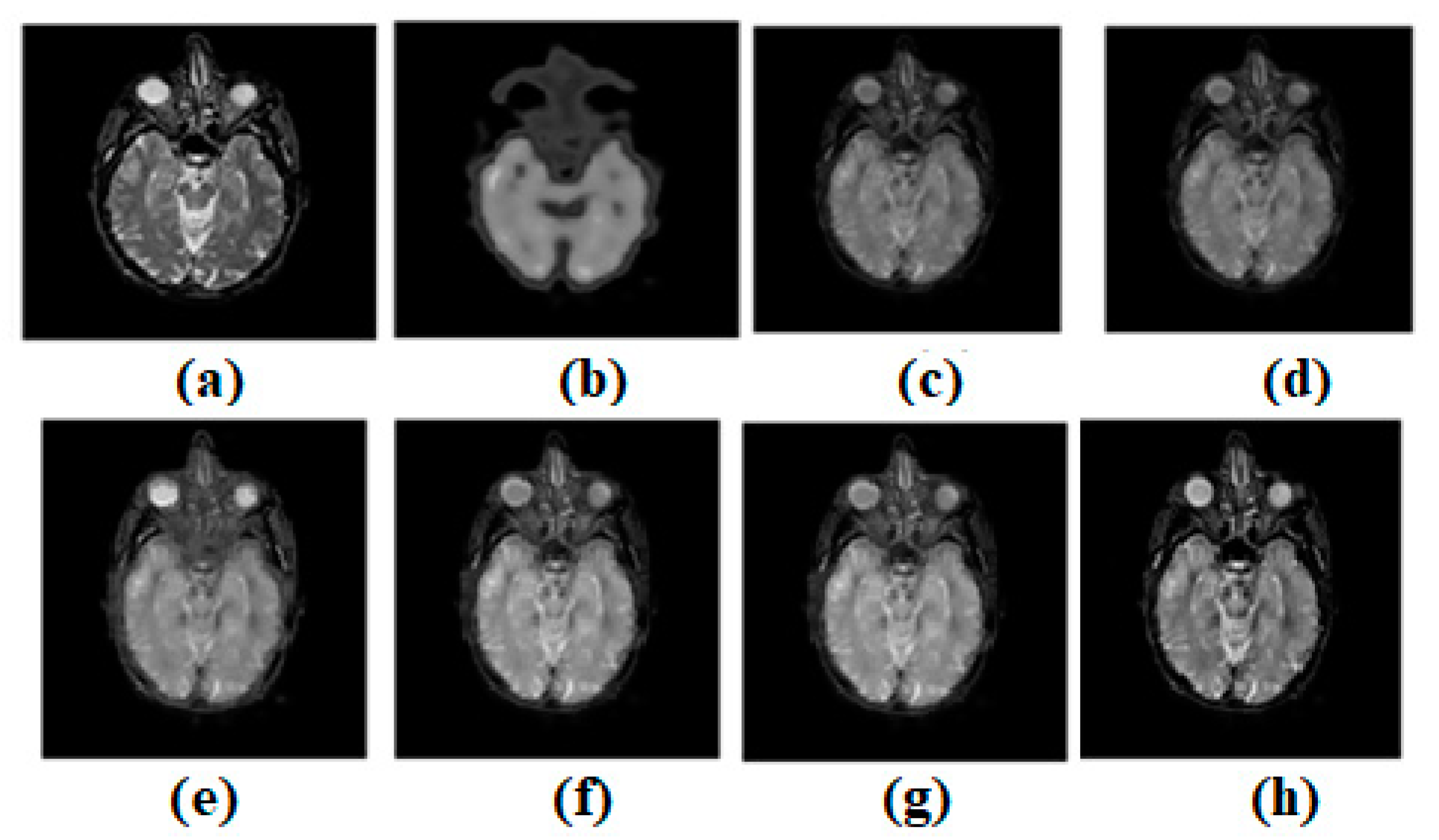 A Non-Conventional Review on Multi-Modality-Based Medical Image Fusion