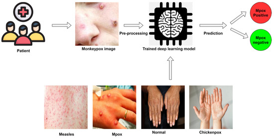 Diagnostics | Free Full-Text | Application of Artificial Intelligence ...
