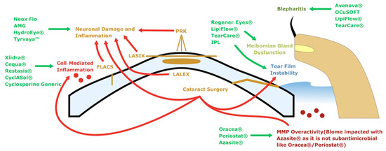 Solving STODS—Surgical Temporary Ocular Discomfort Syndrome