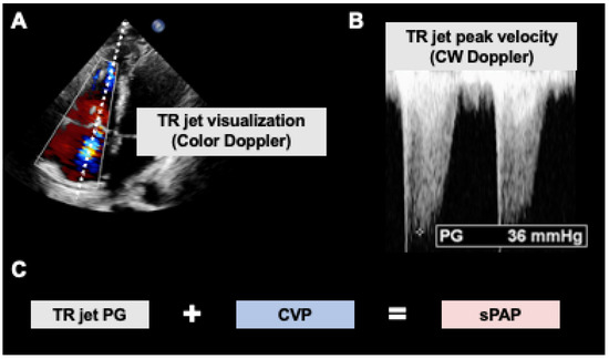 Diagnostics | Free Full-Text | Echocardiography as a Tool to Assess ...