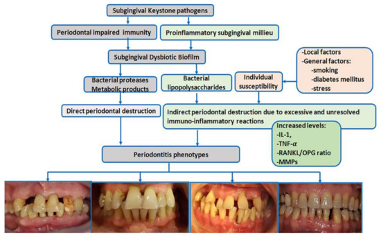 Current Perspectives on Periodontitis in Systemic Sclerosis ...