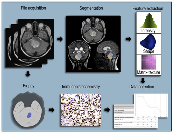 Diagnostic Performance of Selected MRI-Derived Radiomics Able to ...