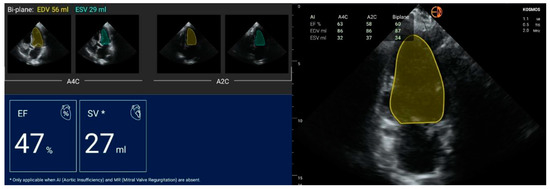 Handheld Echocardiography Measurements Concordance and Findings ...
