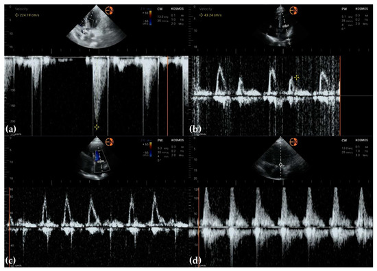 Handheld Echocardiography Measurements Concordance and Findings ...