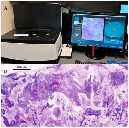Confocal Microscopy for Diagnosis and Management of Cutaneous ...