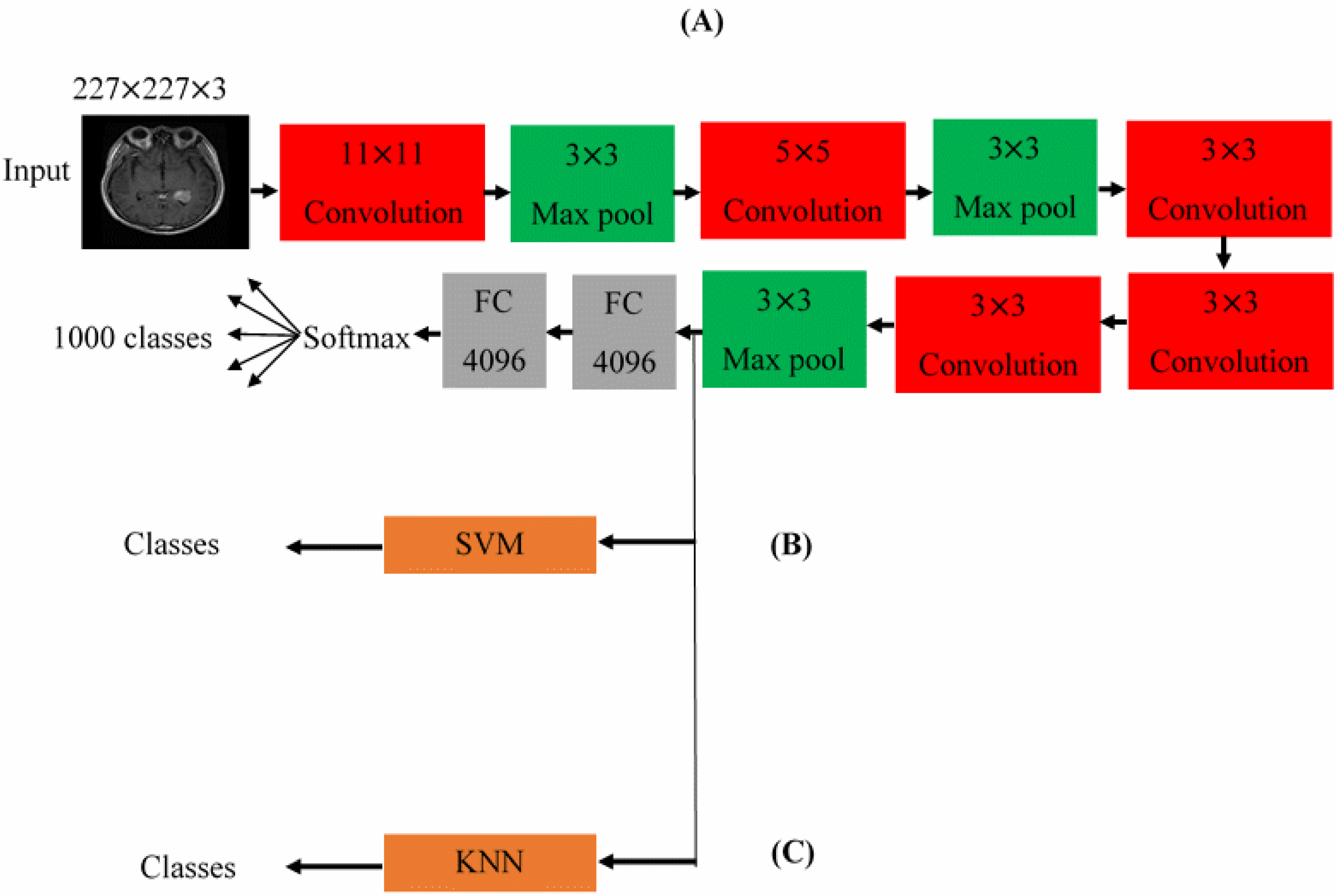Refined Automatic Brain Tumor Classification Using Hybrid Convolutional Neural Networks for MRI ...