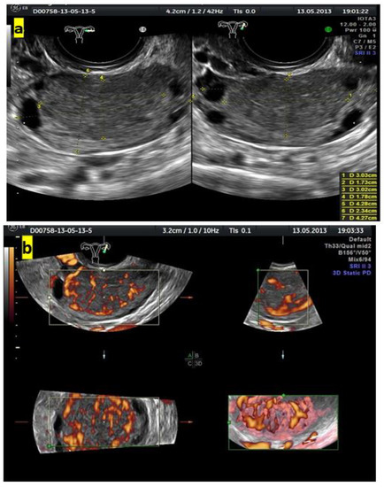 Performance of IOTA Simple Rules Risks, ADNEX Model, Subjective ...