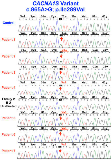 A Mutation in CACNA1S Is Associated with Multiple Supernumerary Cusps ...