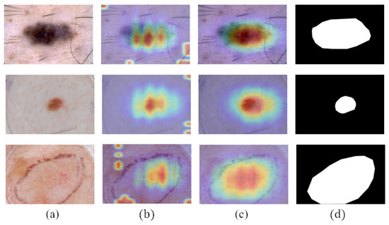 Diagnostics | Free Full-Text | A Collaborative Learning Model for Skin ...