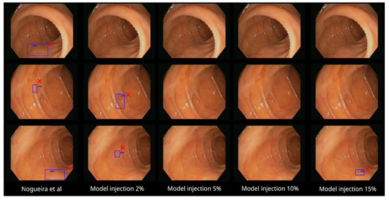 Negative Samples for Improving Object Detection—A Case Study in AI-Assisted Colonoscopy for ...