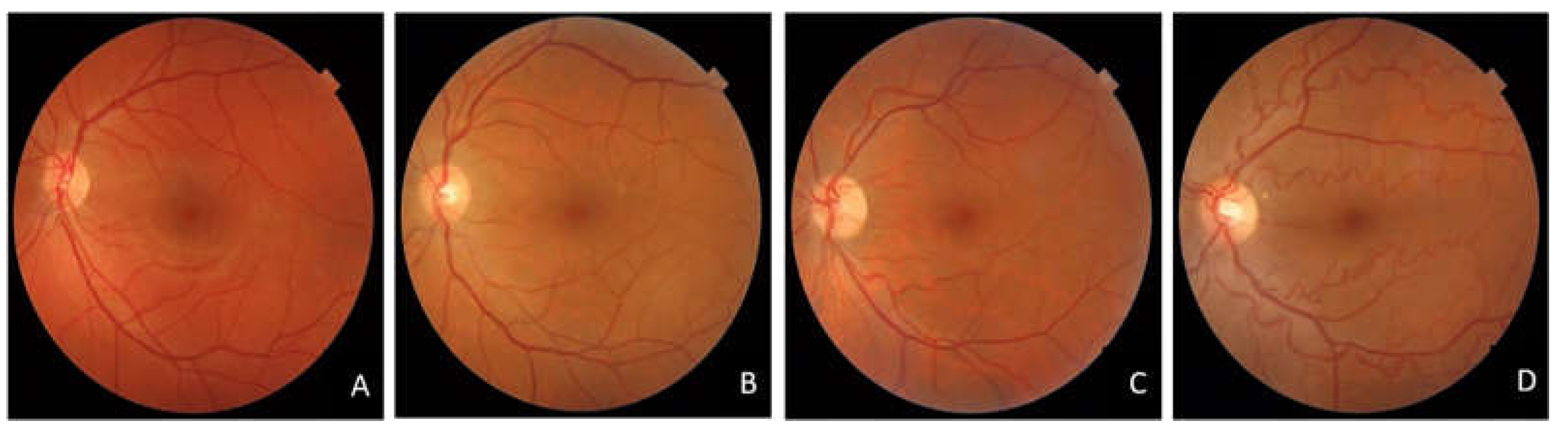 Diagnostics | Free Full-Text | Artificial Intelligence for Evaluation ...