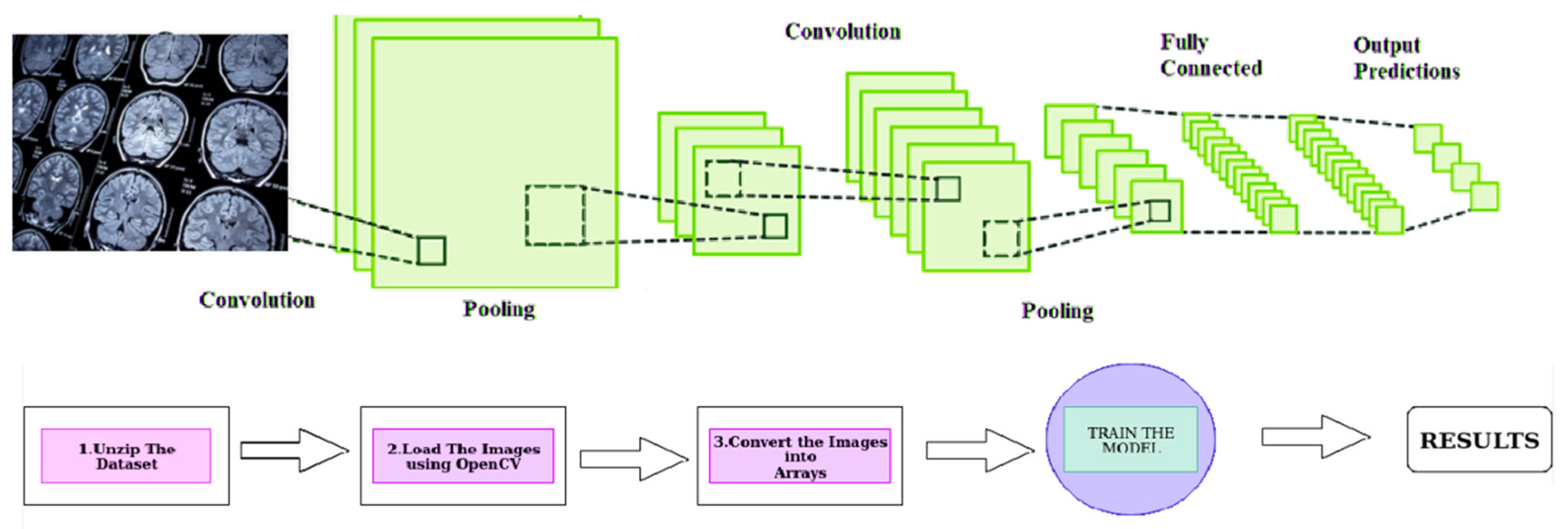 Diagnostics | Free Full-Text | Hybrid Deep Learning Approach for Accurate Tumor Detection in ...
