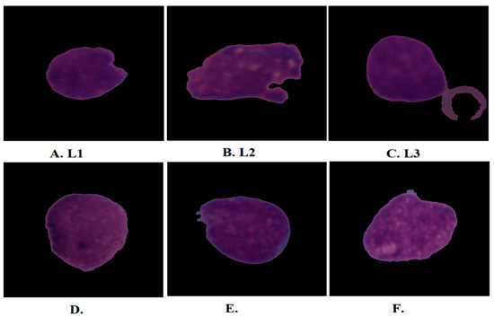 Diagnostics | Free Full-Text | Hybrid Techniques for the Diagnosis of Acute Lymphoblastic ...