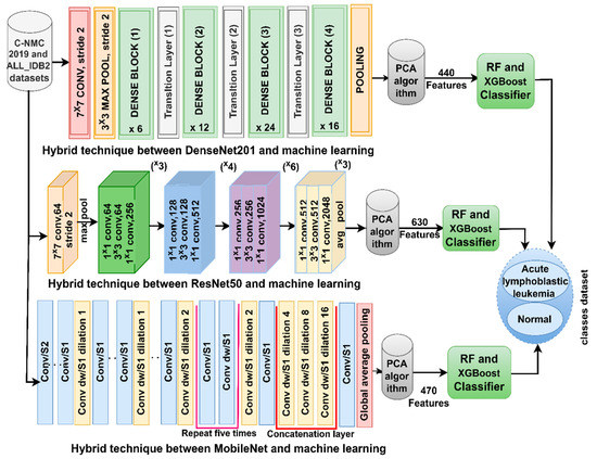 Diagnostics | Free Full-Text | Hybrid Techniques for the Diagnosis of Acute Lymphoblastic ...