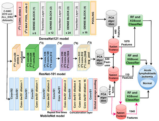 Diagnostics | Free Full-Text | Hybrid Techniques for the Diagnosis of Acute Lymphoblastic ...