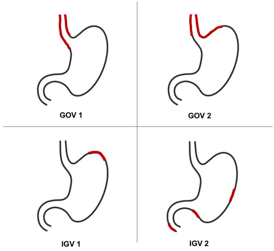 Diagnostics | Free Full-Text | Diagnosis and Management of ...