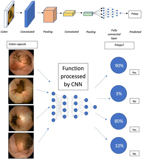 Clinicians’ Guide to Artificial Intelligence in Colon Capsule Endoscopy ...