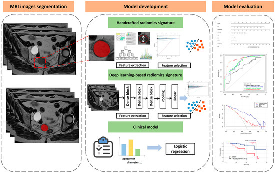 A Deep Learning Radiomics Nomogram to Predict Response to Neoadjuvant Chemotherapy for Locally ...