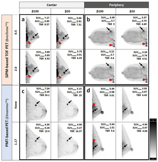 Diagnostics | Free Full-Text | Organ-Specific Positron Emission Tomography Scanners for Breast ...