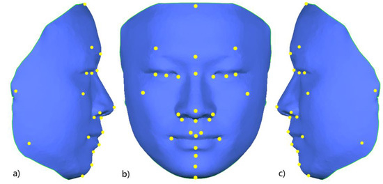 Comparison Study of Extraction Accuracy of 3D Facial Anatomical ...