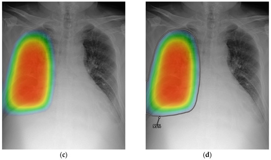 Methods of Visualizing the Results of an Artificial-Intelligence-Based Computer-Aided Detection ...