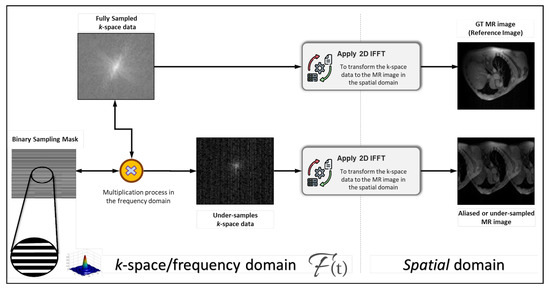 Diagnostics | Free Full-Text | A Deep Learning Framework for Cardiac MR Under-Sampled Image ...
