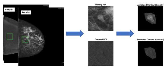 Predicting Malignancy of Breast Imaging Findings Using Quantitative ...