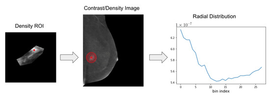 Predicting Malignancy of Breast Imaging Findings Using Quantitative ...